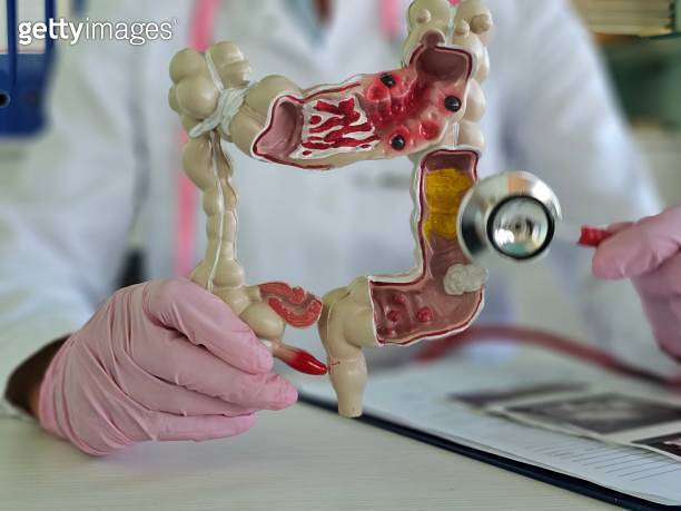 Doctor showing model of large intestine at table (2172052382) - 게티이미지뱅크