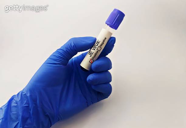 Diagnostician holding in hand a positive JE (Japanese encephalitis ...