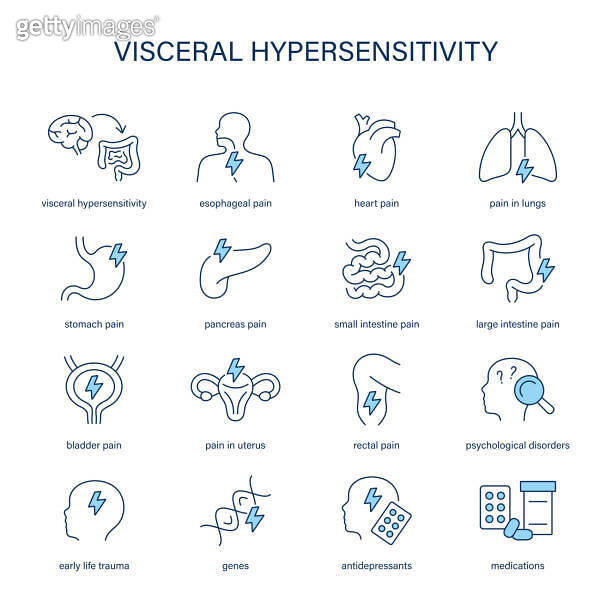 Visceral Hypersensitivity symptoms, diagnostic and treatment vector ...