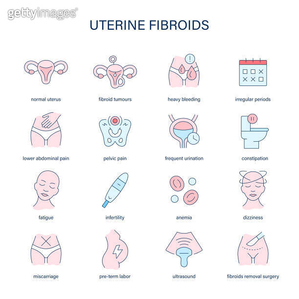 Uterine Fibroids symptoms, diagnostic and treatment vector icons ...