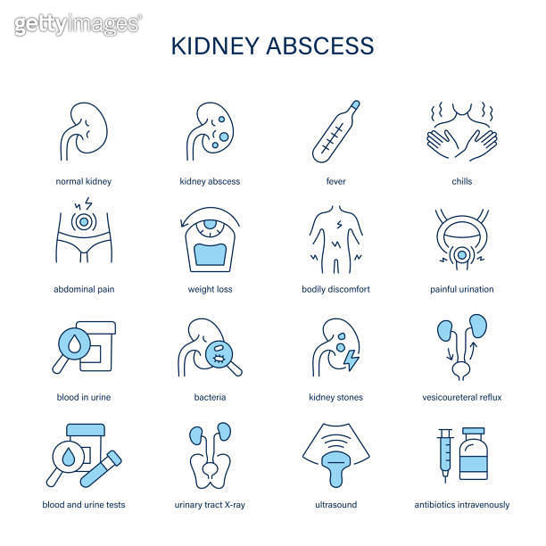 Kidney Abscess symptoms, diagnostic and treatment vector icons. Medical ...