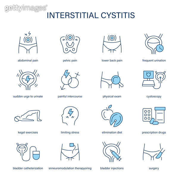 Interstitial Cystitis symptoms, diagnostic and treatment vector icons ...