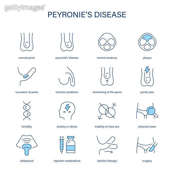 Peyronie's Disease symptoms, diagnostic and treatment vector icons ...
