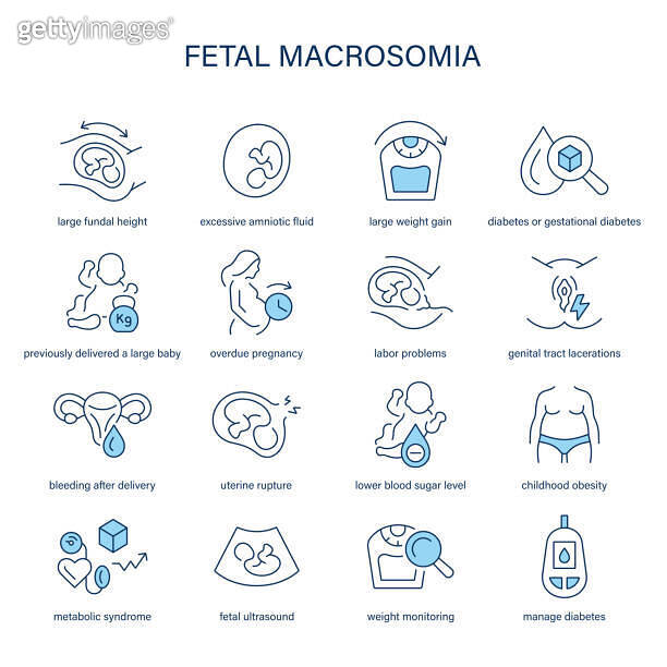 Fetal Macrosomia symptoms, diagnostic and treatment vector icons ...