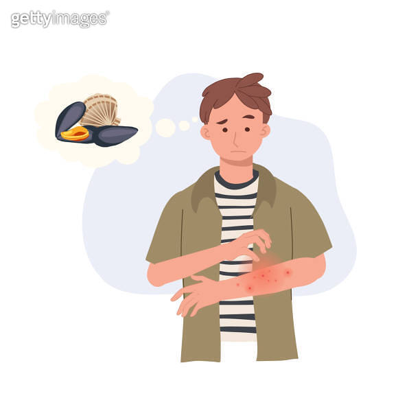 seafood Allergy Reaction. man with Itchy Red Rash on Arm. Allergic Skin ...