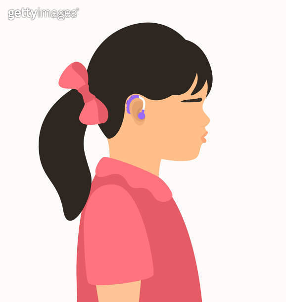 Side View Of Little Girl With Hearing Aid On Her Ear. Hearing Loss And ...