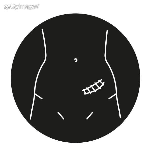 Rutherford morrison incision line icon. Abdominal incisions. 이미지 ...