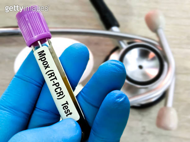 Biological specimens for Monkey pox (Mpox) virus RT PCR test ...