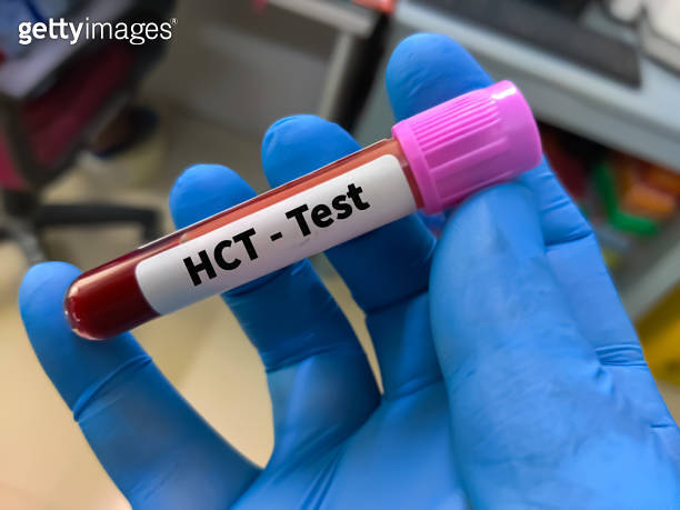 HCT. Hematocrit blood testing concept. 이미지 (2155962342) - 게티이미지뱅크