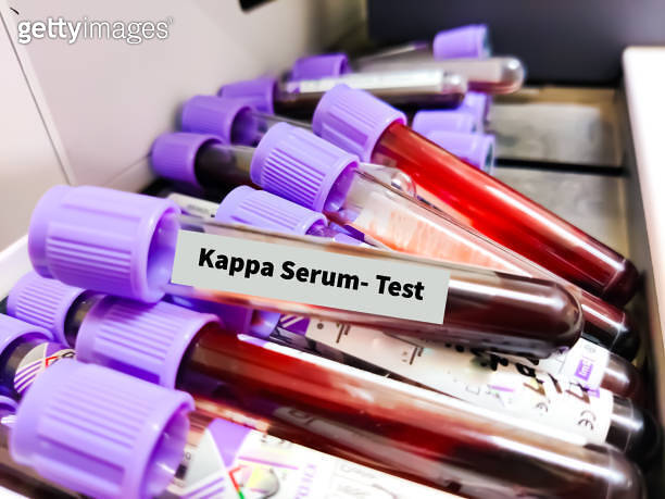 Blood sample for Kappa serum testing concept. 이미지 (2156265107) - 게티이미지뱅크