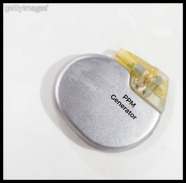Dual chamber permanent pacemaker (PPM) Generator for converts analog ...