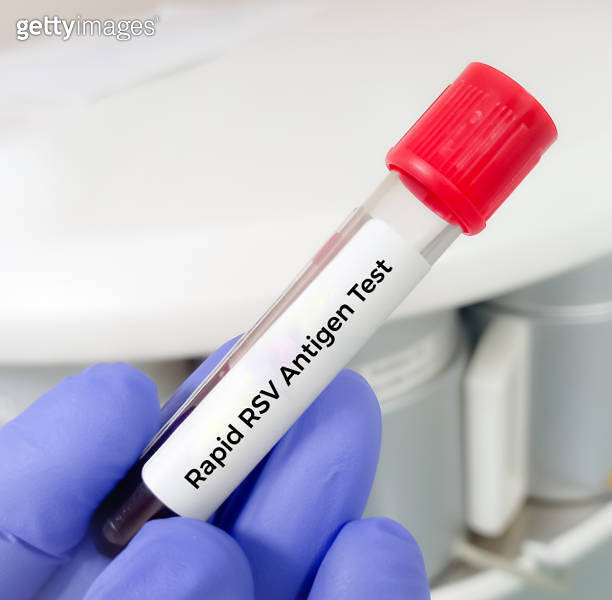 Blood sample for RSV (respiratory syncytial virus) test, Rapid RSV ...