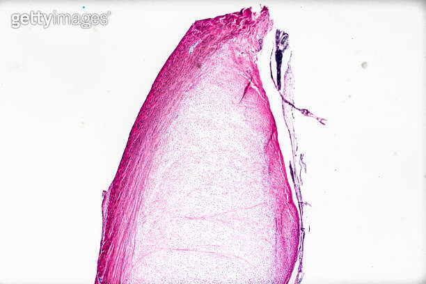 histology sample Human Dense Connective Tissue (tendon) sec under light ...