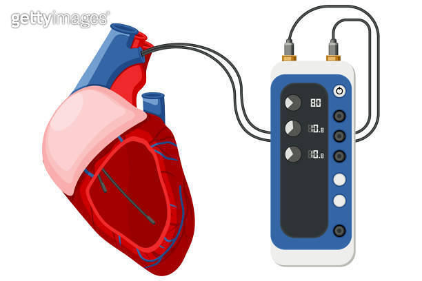 Medical equipment, pacemakers cardiac external temporary permanent ...