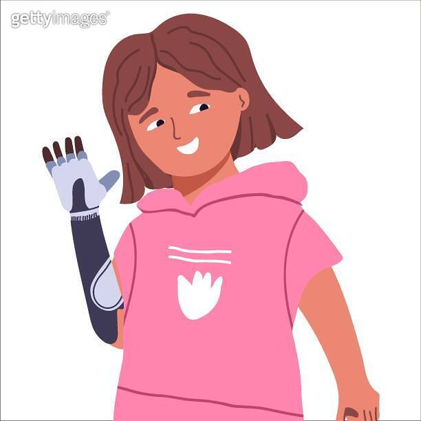 Cute little girl with prosthetic arm waving. Cute smiling friendly ...