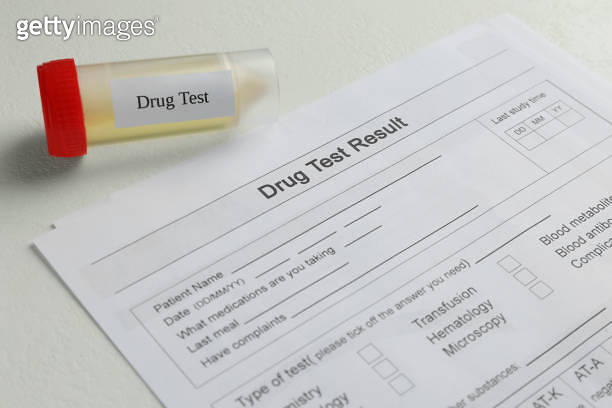 Drug test result form and container with urine sample on light table ...