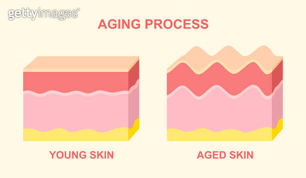 Aging process. comparison of young and aged skin. collagen, elastin and ...