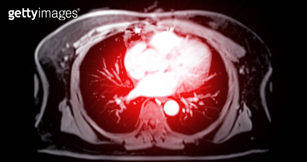 MRI of the upper abdomen is a non-invasive imaging technique providing ...