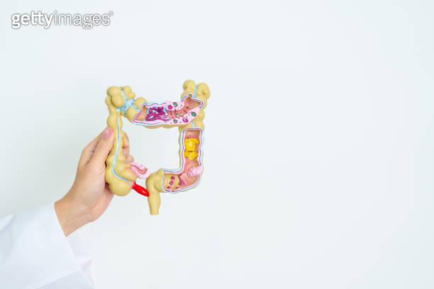 Doctor with human Colon anatomy model. Colonic disease, Large Intestine ...