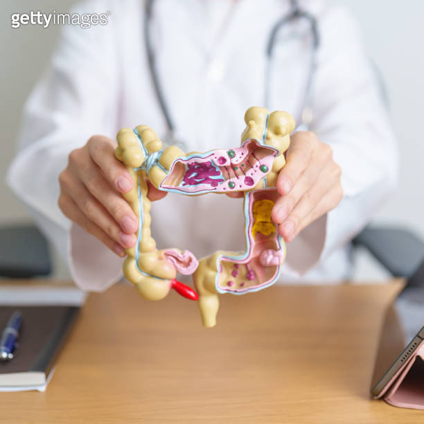 Doctor with human Colon anatomy model and tablet. Colonic disease ...