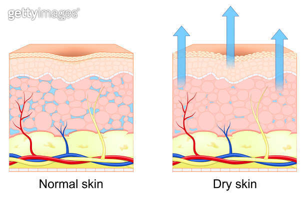 Dry and normal human skin. 이미지 (2159152270) - 게티이미지뱅크