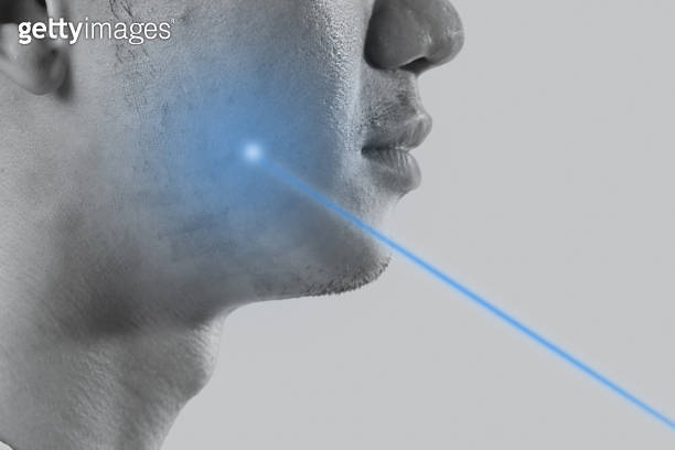 Closeup man with blue bright laser beam directed at the skin for ...