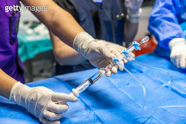 The procedure of inserting a double lumen catheter into a patient with ...