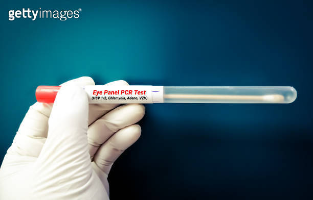 Eye PCR Panel (HSV1, HSV2, VZV, Adeno virus and Chlamydia) test 이미지 ...