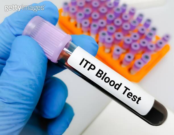 Immune thrombocytopenic purpura (ITP) test, ITP is a blood disorder ...