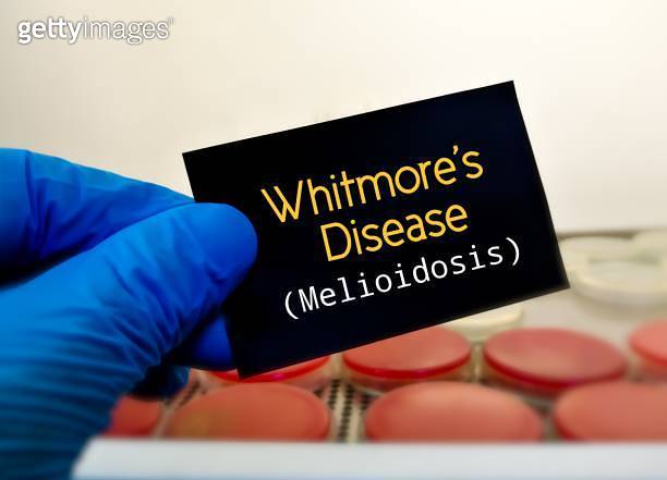 Whitmore's disease or Melioidosis is caused by the bacteria ...
