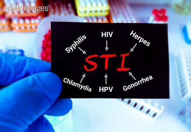 STI (Sexually Transmitted Infection) term. HIV, Syphilis, Herpes, HPV ...