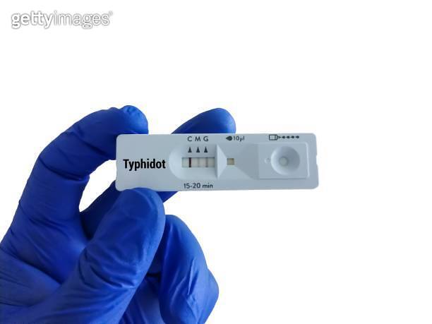 Rapid screening test for Typhidot test, to diagnose typhoid fever ...