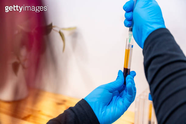 Woman extracting blood from tube sample in a dermatology lab ...