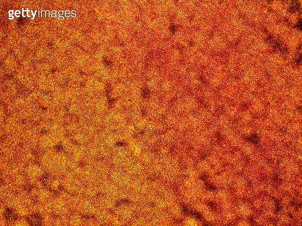 tomato skin under the microscope (Solanum lycopersicum) - optical ...