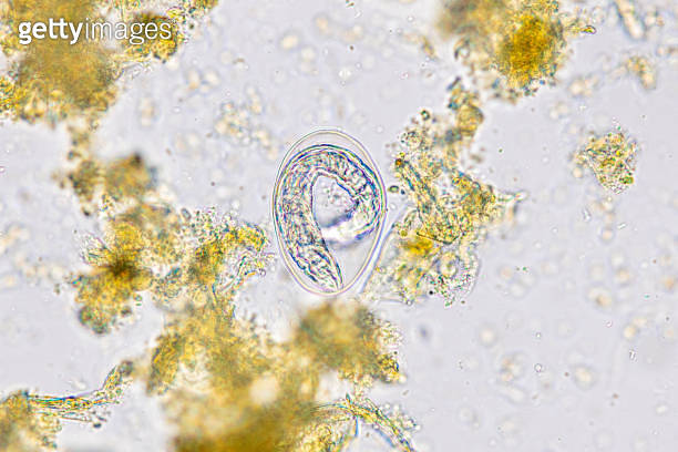 Finding Trichuris trichiura egg and Strongyloides egg in the feces ...