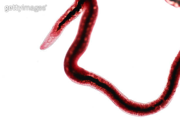 Parasitic helminths (Trematodes) and Ascaris of fishes under a ...