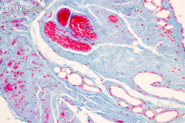 Backgrounds of Characteristics Touch corpuscles in Human skin under the ...