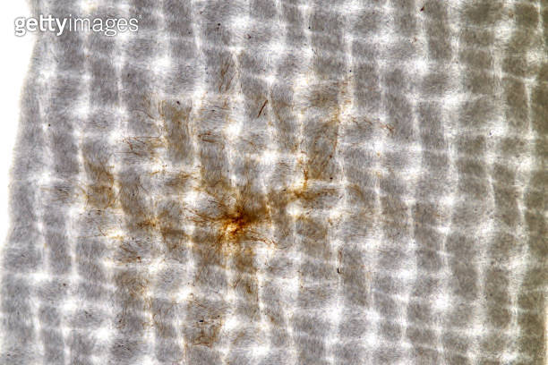 Host cells with spores (mold) are inside wood under the microscope for ...