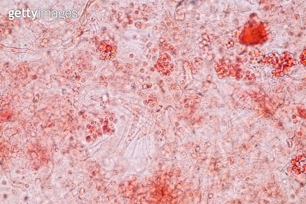 Host cells with spores (mold) are inside wood under the microscope for ...