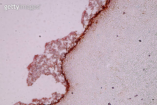 Host cells with spores (mold) are inside wood under the microscope for ...