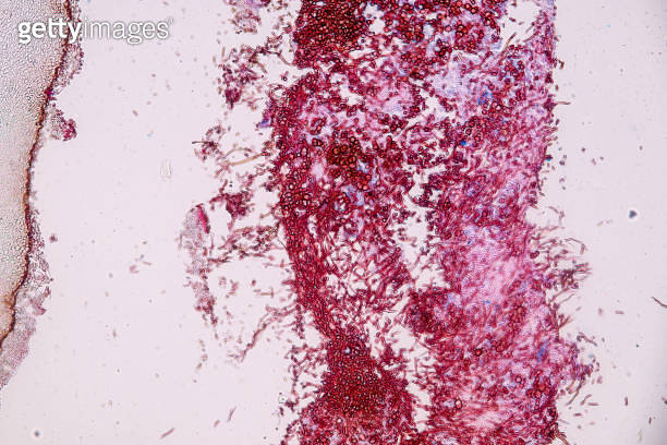 Host cells with spores (mold) are inside wood under the microscope for ...