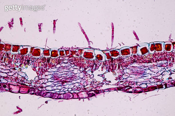 Host cells with spores (mold) are inside wood under the microscope for ...