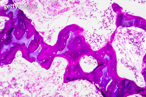 Tissue sample of Bone human, Elastic cartilage human and Red bone ...