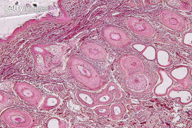 Tissue sample of Bone human, Elastic cartilage human and Red bone ...