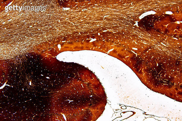 Histological Brain of mouse, Cerebellum, Sympathetic ganglion And ...