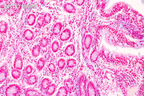 Backgrounds of Characteristics Tissue of Jejunum human under microscope ...