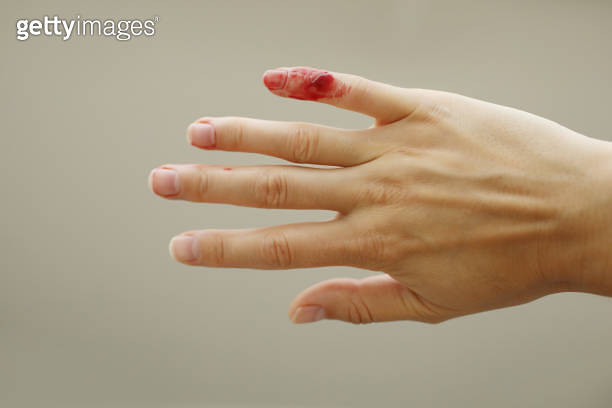 Female hand with red blood, little finger is bleeding profusely. Woman ...