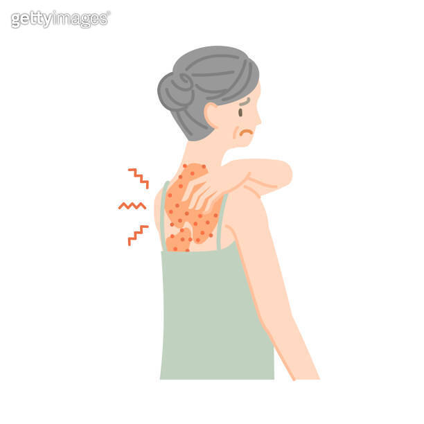 A senior woman whose back skin is rough, inflamed, and itchy 이미지 ...
