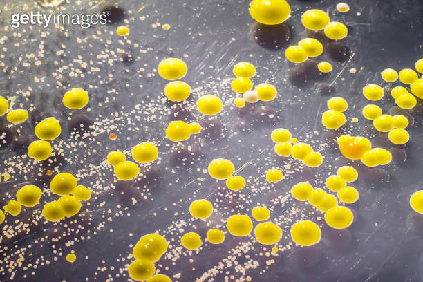Bacteria grown from a skin smear, colonies of Micrococcus luteus and ...