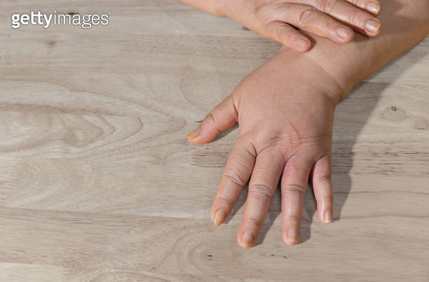 Cancer chemotherapy cause swelling hand , skin to become dry, dark or ...